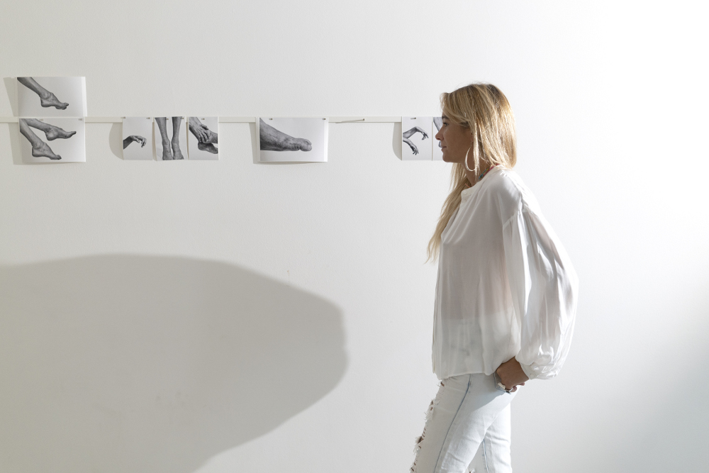 Aliteia espone per ACMT-Rete Malattia di Charcot-Marie-Tooth