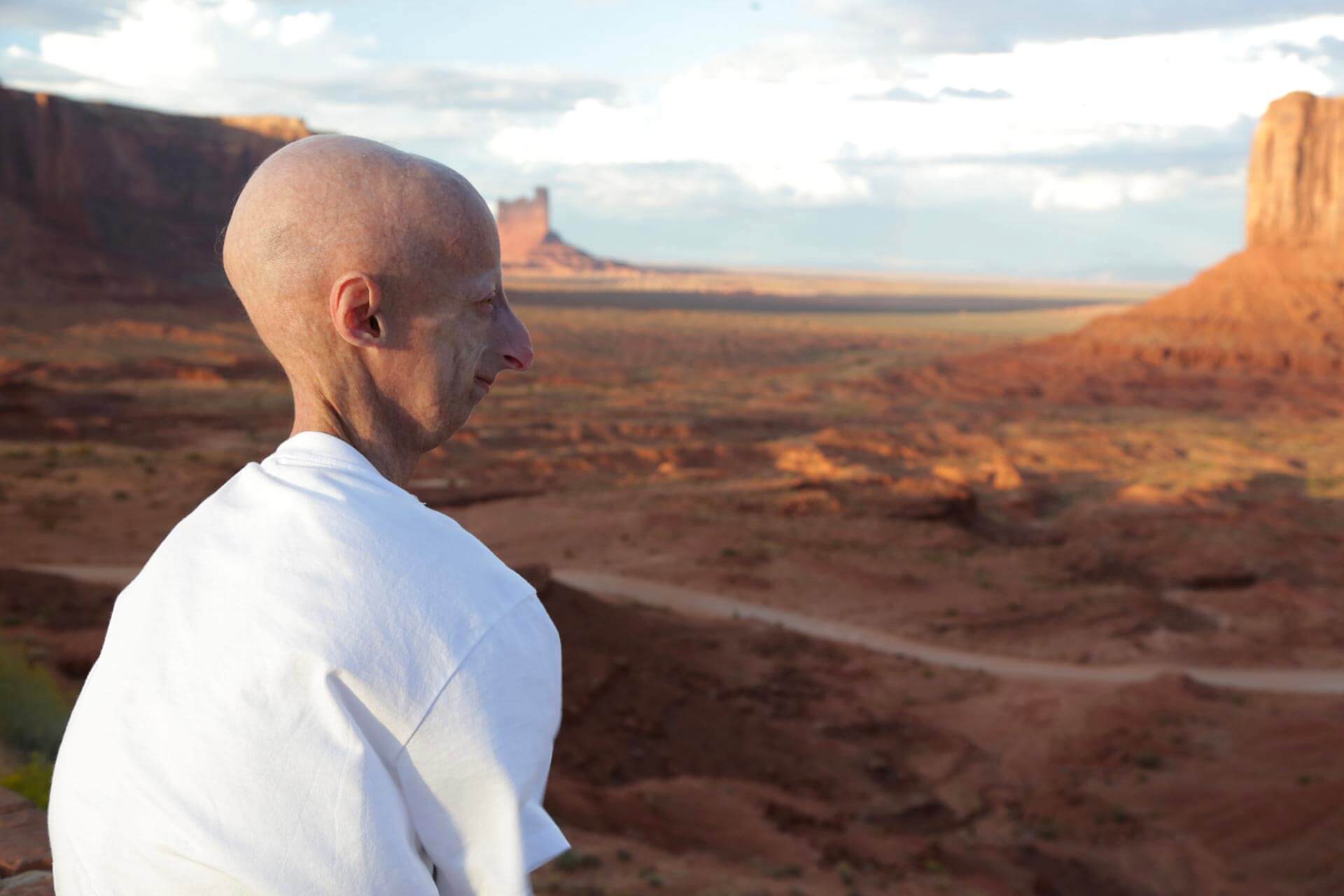 Sammy Basso non c'è più "un esempio di forza e determinazione" - Vipiù